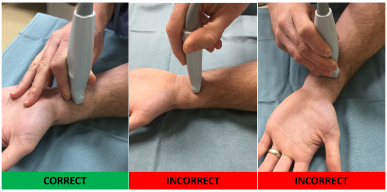 Understanding ultrasound probes | kidSONO