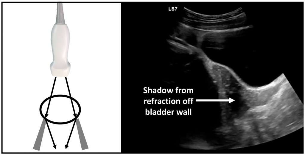 Translating sound into light | kidSONO