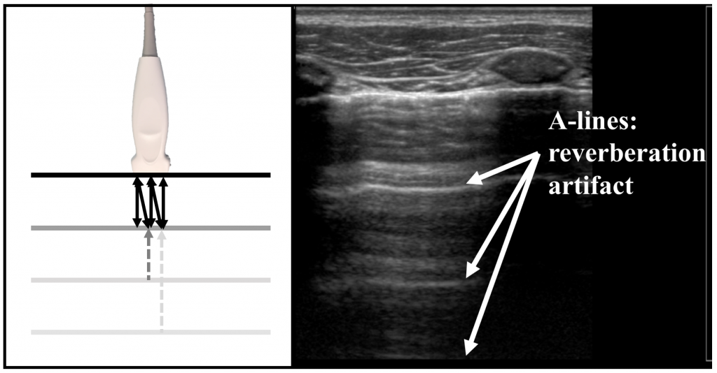 Translating sound into light | kidSONO