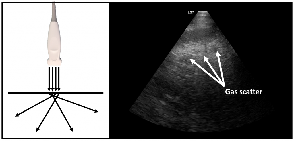 Translating sound into light | kidSONO