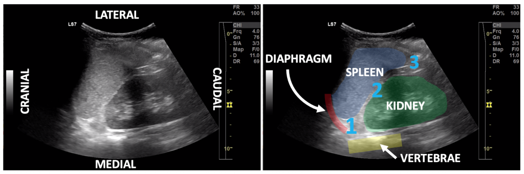 Left upper quadrant | kidSONO