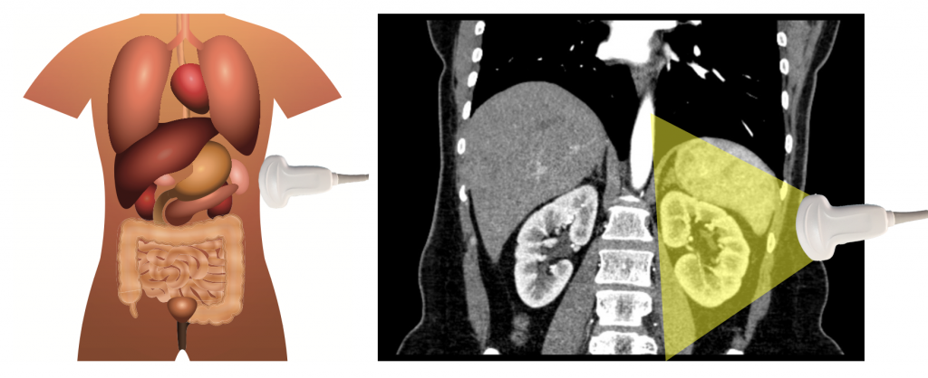 Left upper quadrant | kidSONO