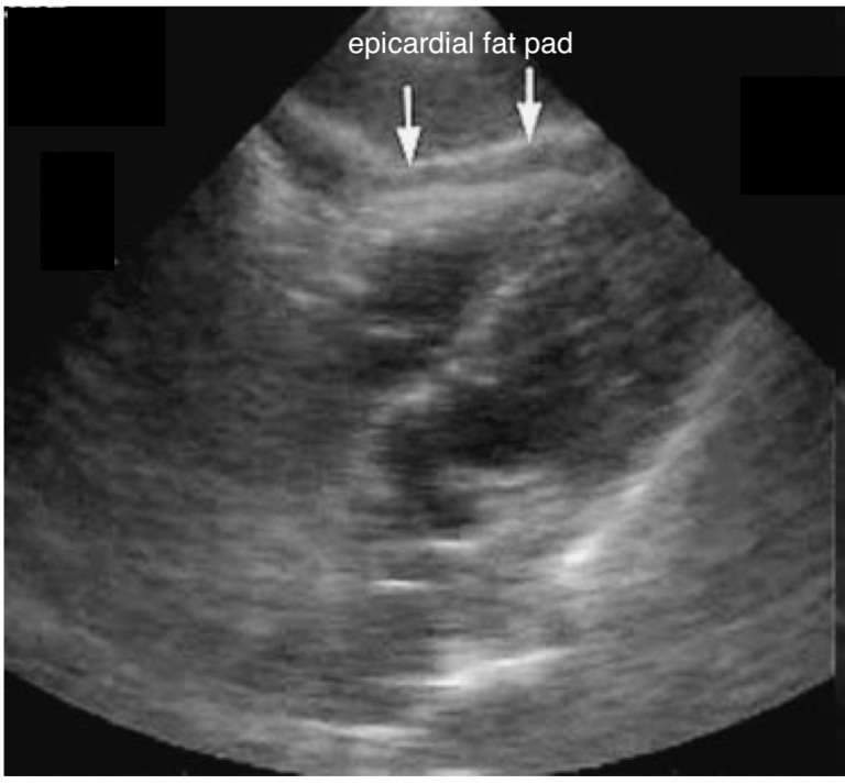What is normal? | kidSONO