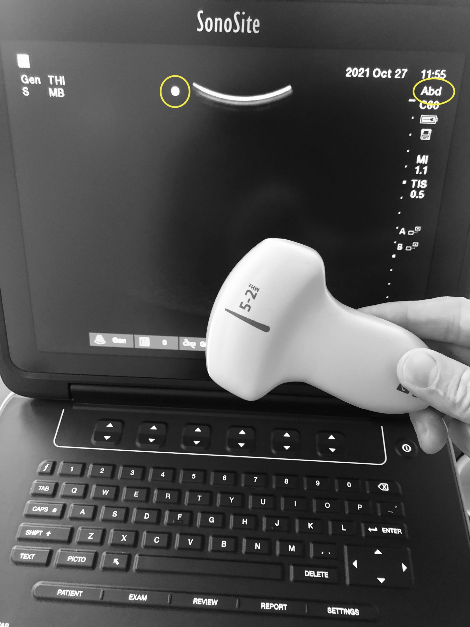 Indications | kidSONO