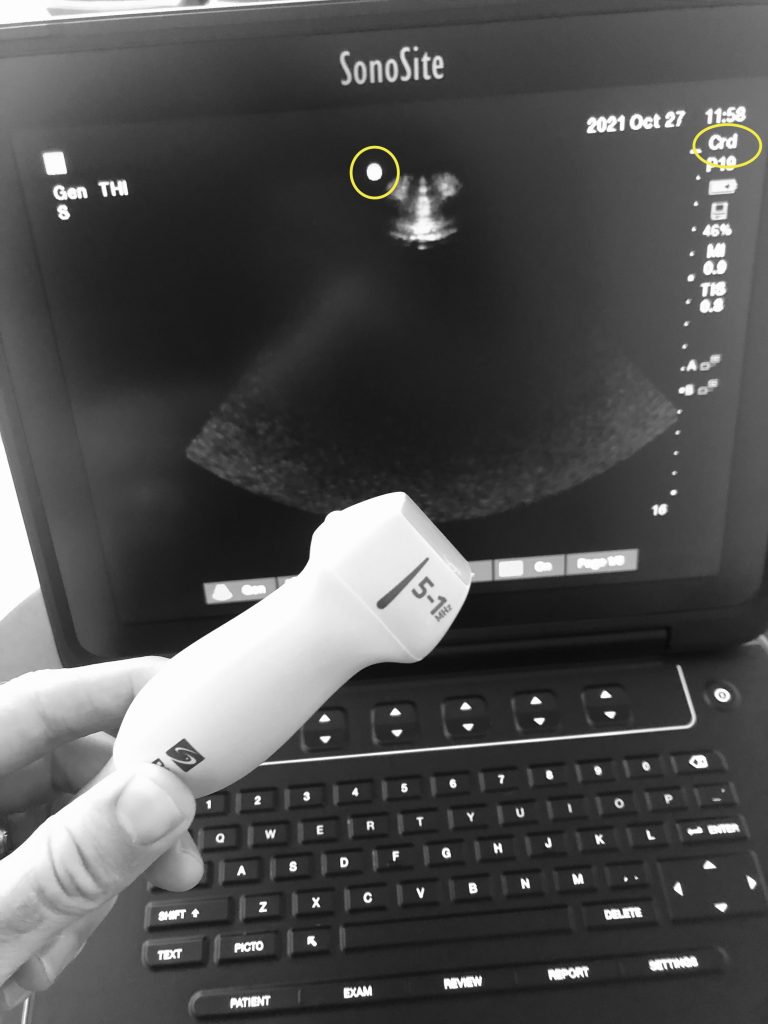 Indications | kidSONO